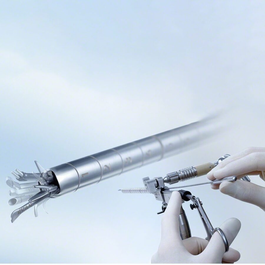 Intraventricular Neuroendoscopy Systems